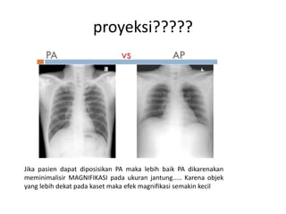 THORAX.pptx