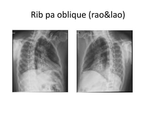 THORAX.pptx