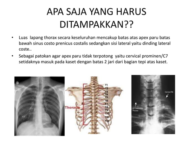 THORAX.pptx