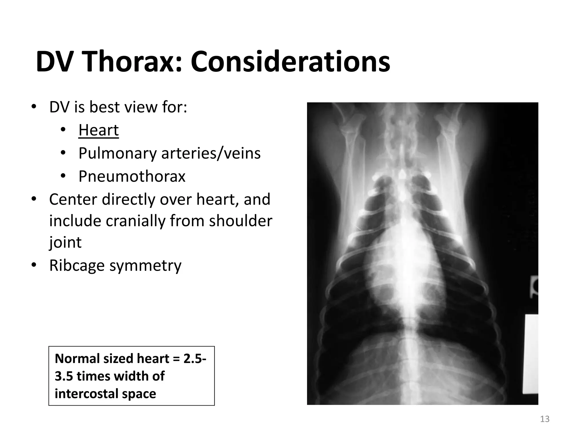 thorax.ppt