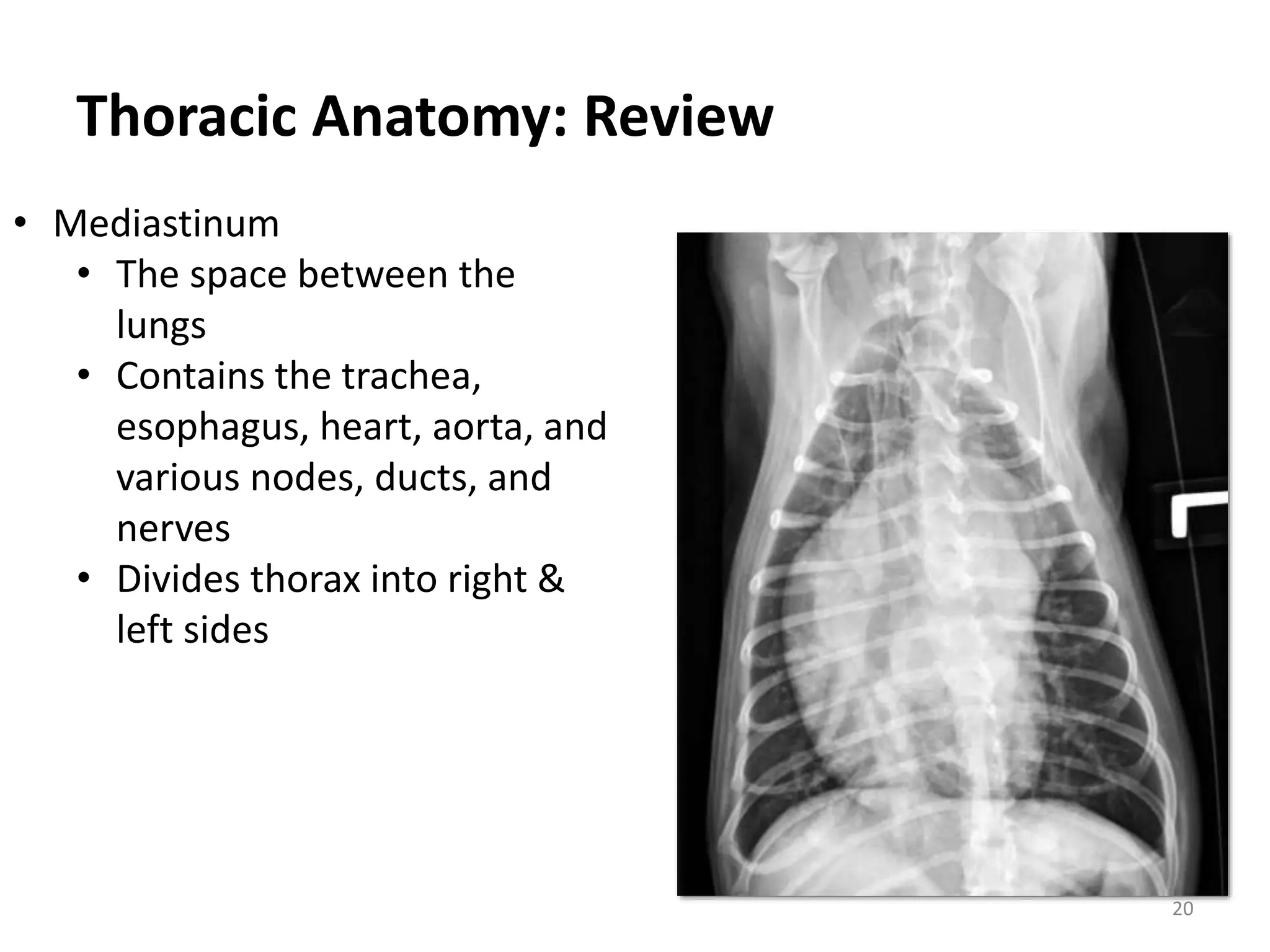 thorax.ppt