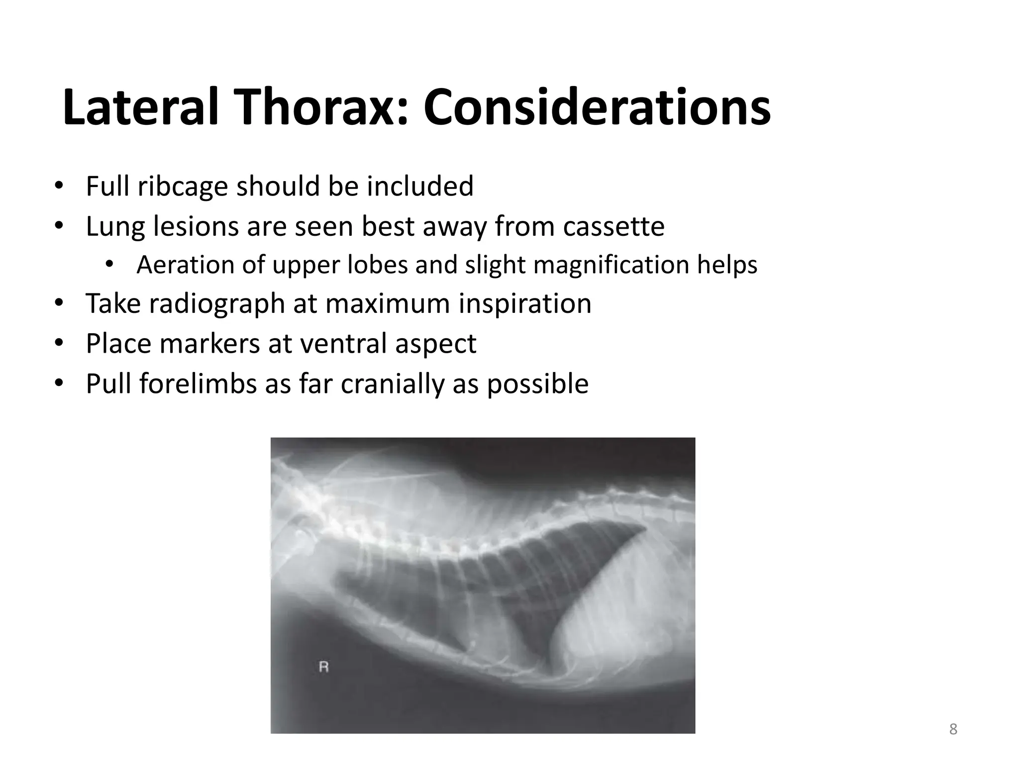 thorax.ppt
