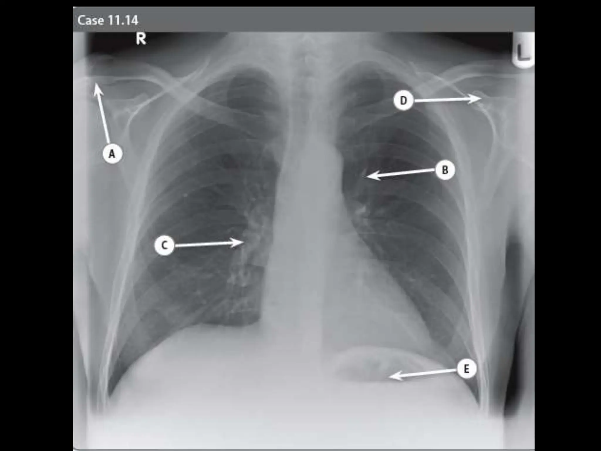 Thorax CT scan for respiratory Physicianpdf | PDF