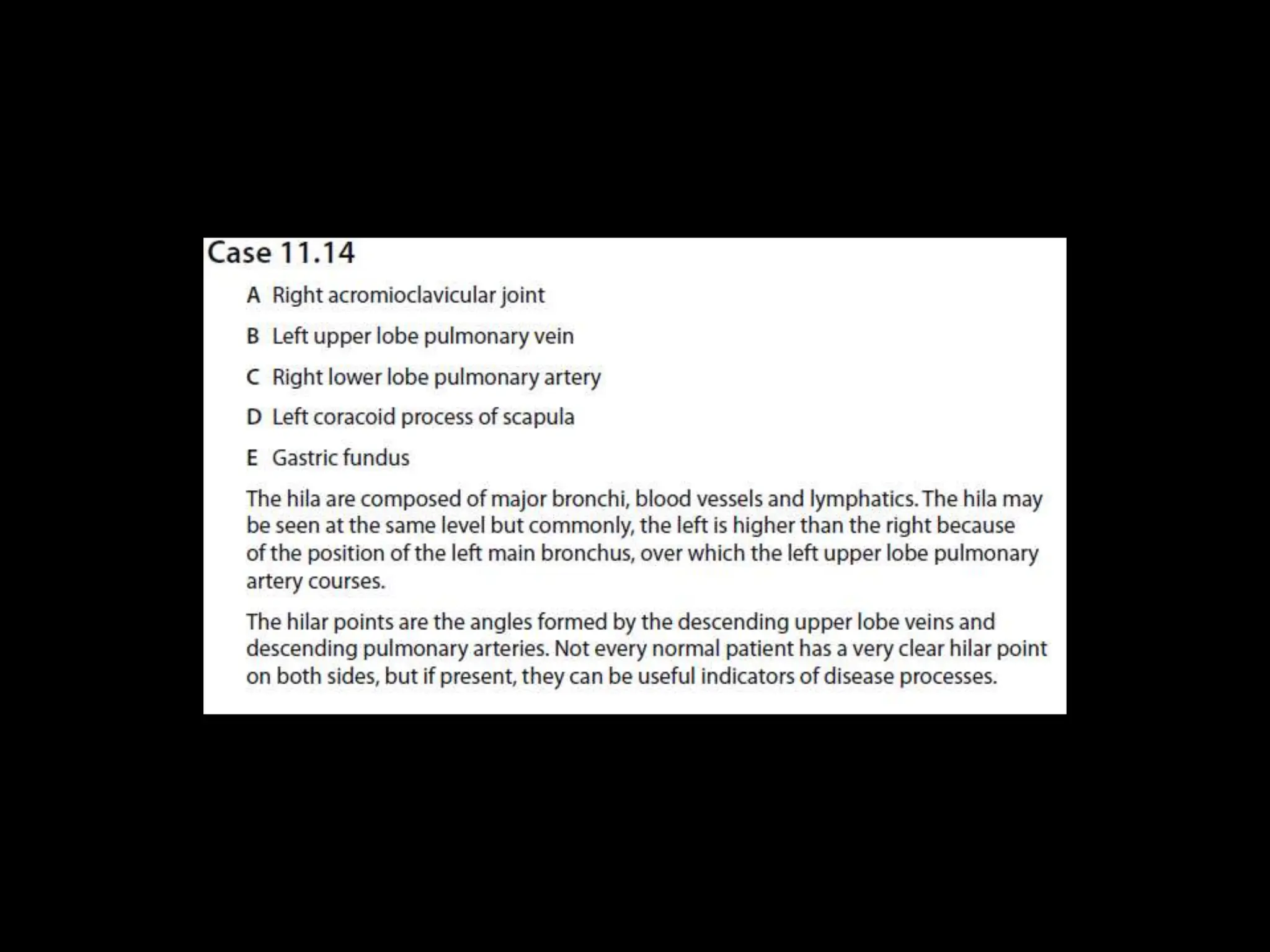 Thorax CT scan for respiratory Physicianpdf | PDF