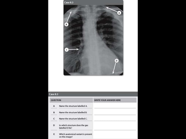 Thorax CT scan for respiratory Physicianpdf | PPT