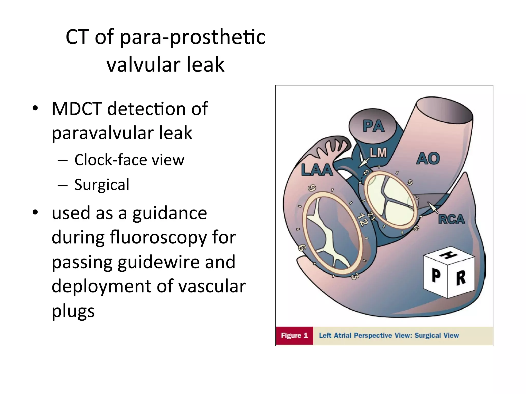 Thorax cardio pre procedure ct s cheung | PDF