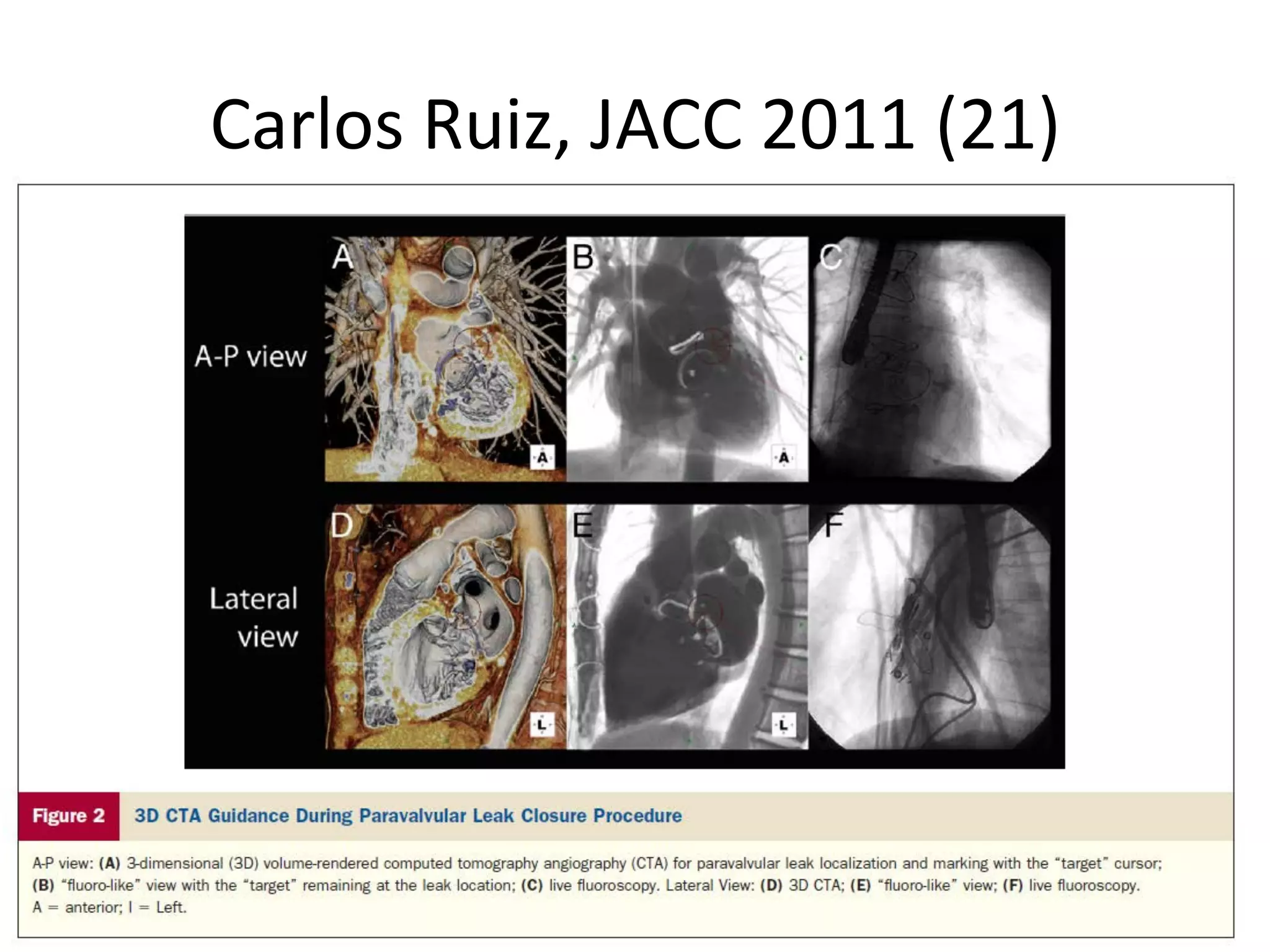 Thorax cardio pre procedure ct s cheung | PDF