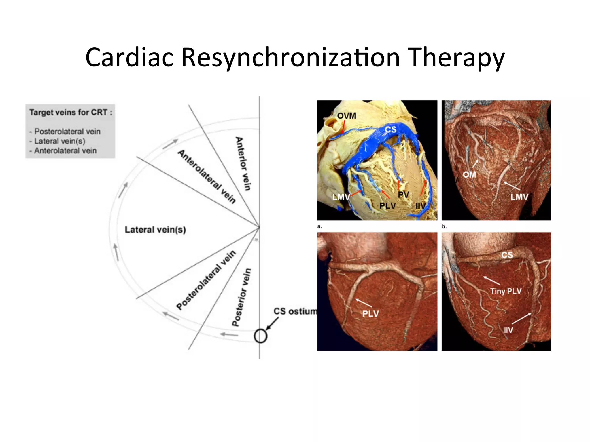 Thorax cardio pre procedure ct s cheung | PDF