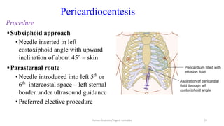 Thorax20Chapter201120Pericardium20Newpdf.pdf