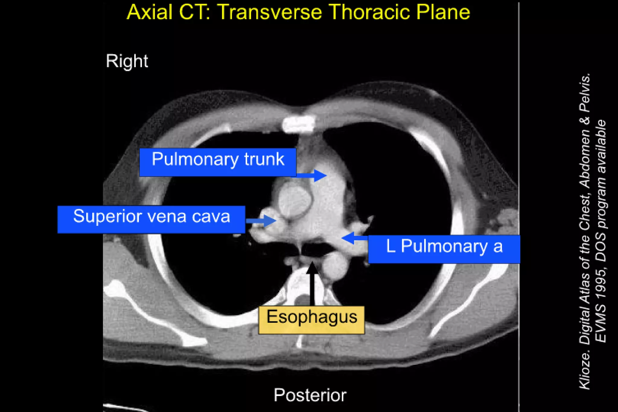 Thorax and Abdomen CT Cheat Sheet | PDF