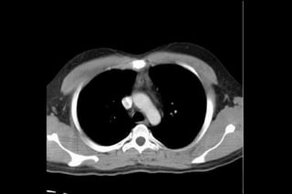 Thorax and Abdomen CT Cheat Sheet | PDF