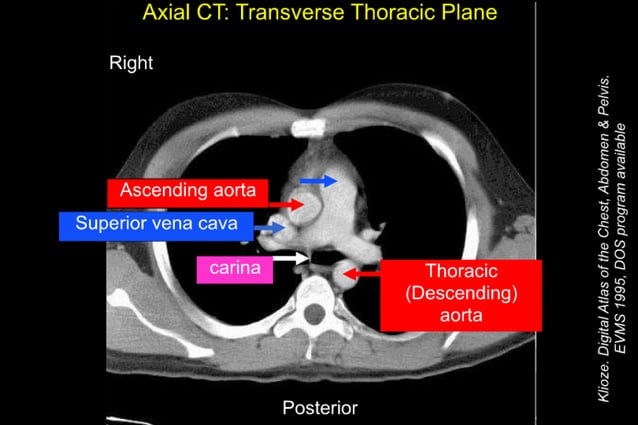 Thorax and Abdomen CT Cheat Sheet | PDF