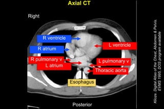 Thorax and Abdomen CT Cheat Sheet | PDF