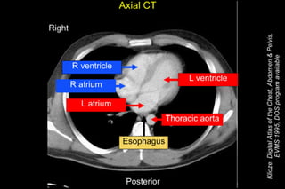 Thorax and Abdomen CT Cheat Sheet | PDF