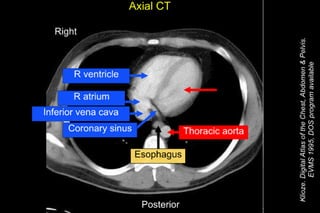 Thorax and Abdomen CT Cheat Sheet
