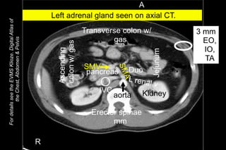 Thorax and Abdomen CT Cheat Sheet