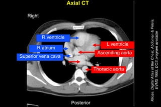Thorax and Abdomen CT Cheat Sheet | PPT