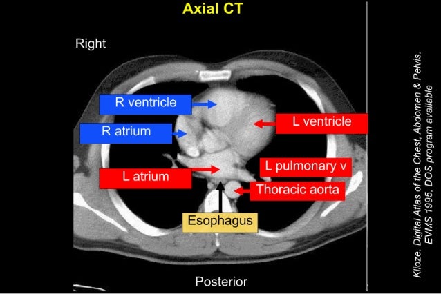 Thorax and Abdomen CT Cheat Sheet