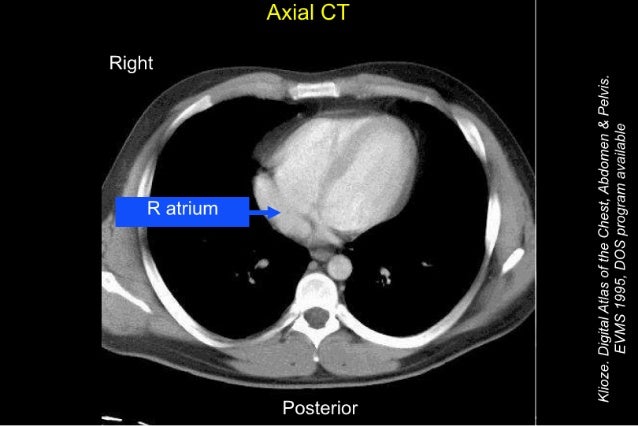 Thorax and Abdomen CT Cheat Sheet