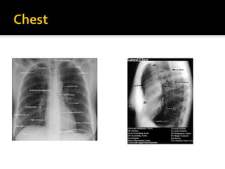 Thorax area | PPTX