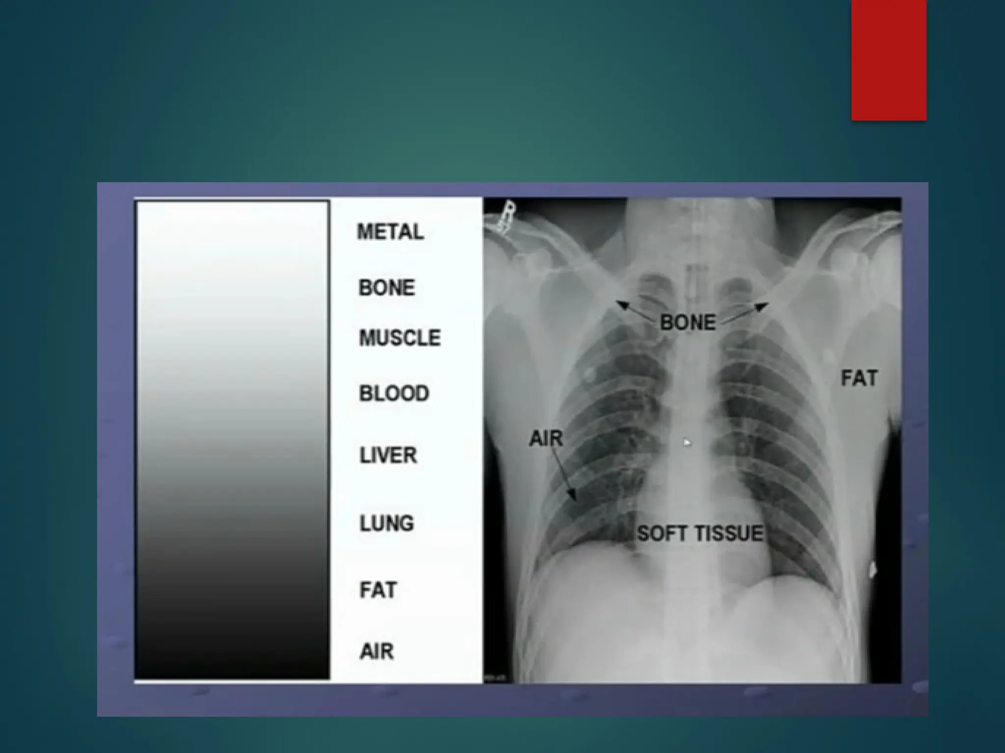 THORAX RADIOGRAPHIC INTERPRETATION CANINE | PPTX