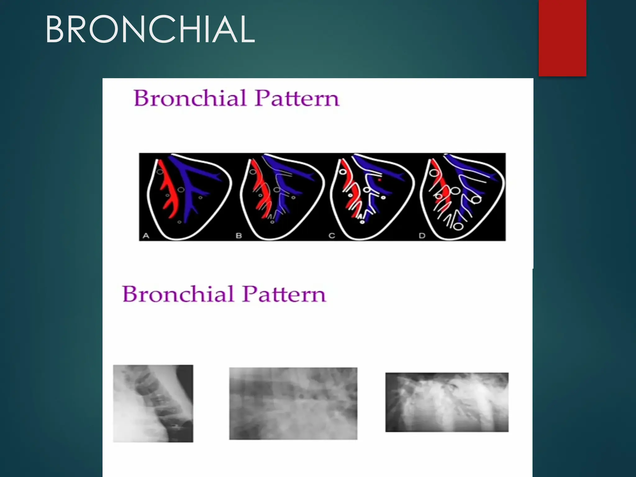THORAX RADIOGRAPHIC INTERPRETATION CANINE | PPTX