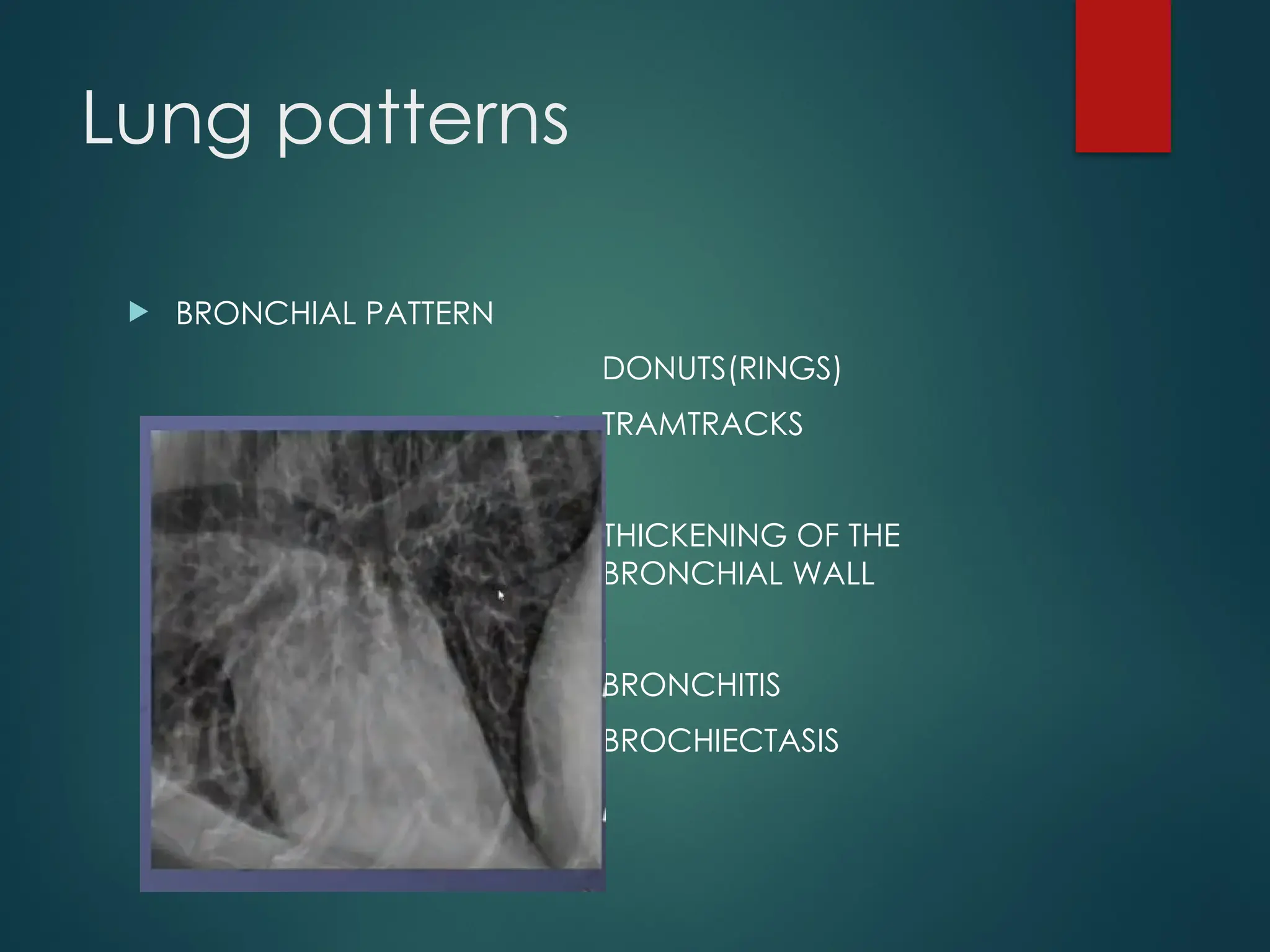 THORAX RADIOGRAPHIC INTERPRETATION CANINE | PPT