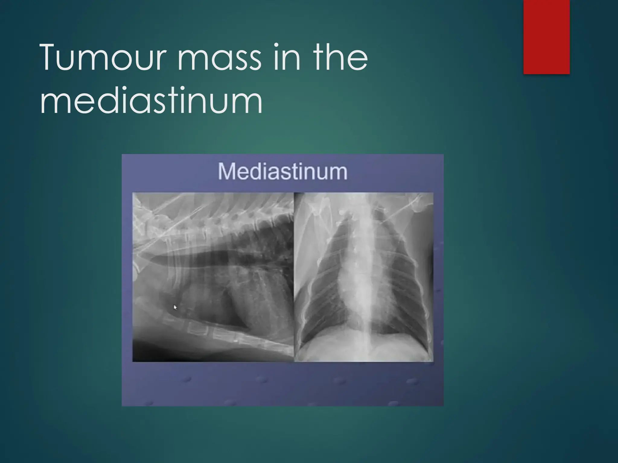 THORAX RADIOGRAPHIC TECHNIQUES INFORTHORAX XRAYMATION | PPT