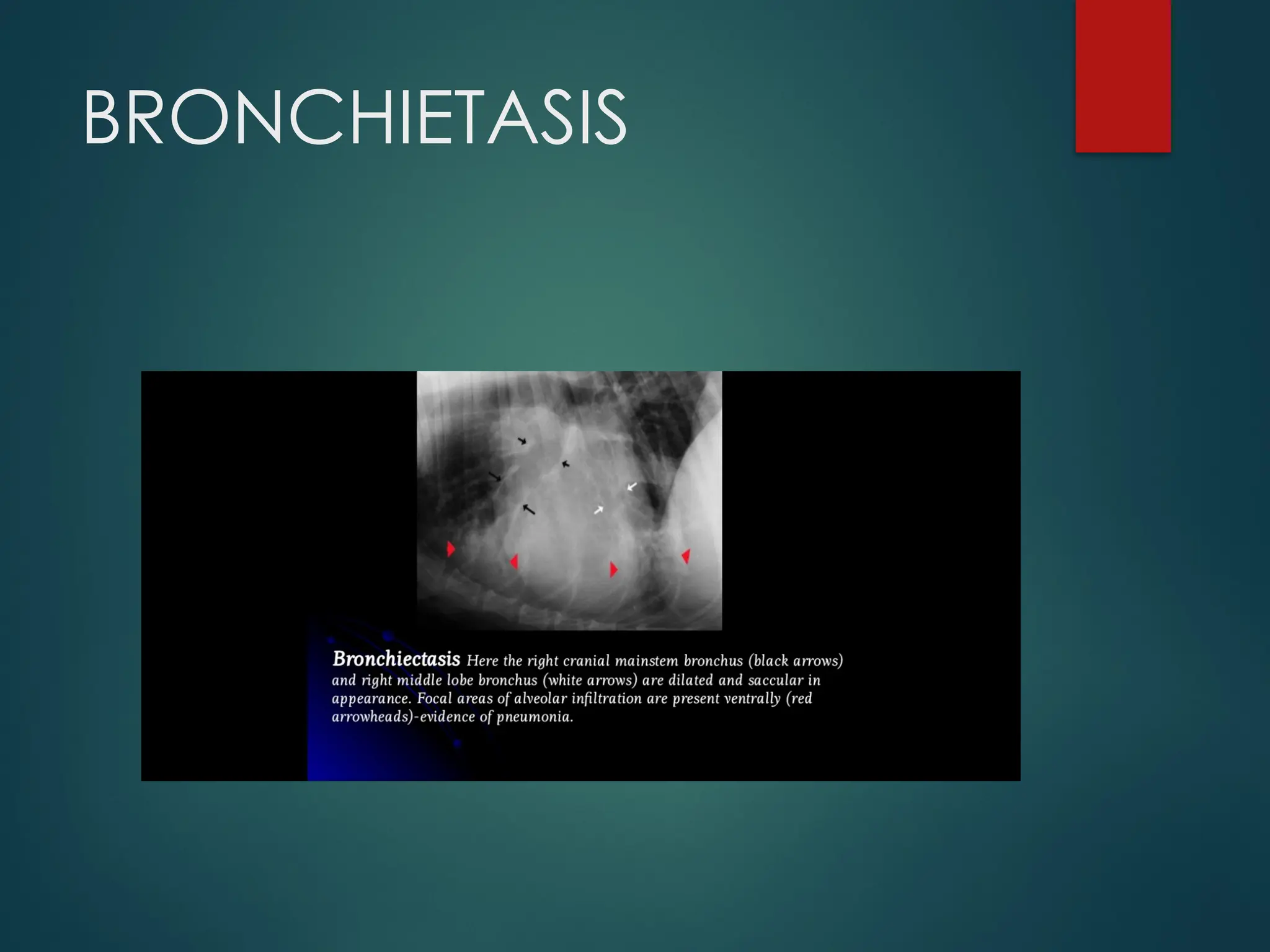 THORAX RADIOGRAPHIC TECHNIQUES INFORTHORAX XRAYMATION | PPT