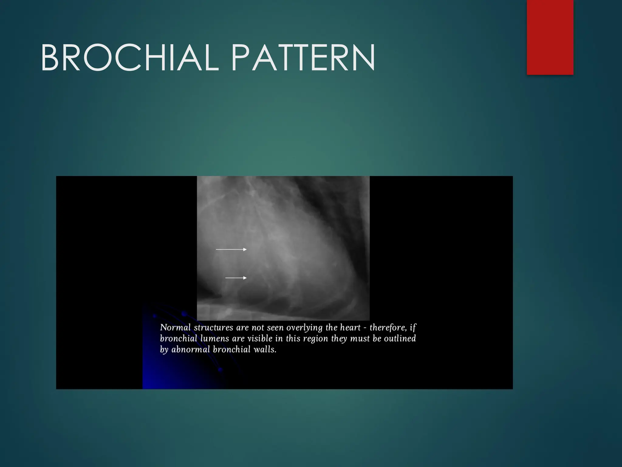 THORAX RADIOGRAPHIC TECHNIQUES INFORTHORAX XRAYMATION | PPT