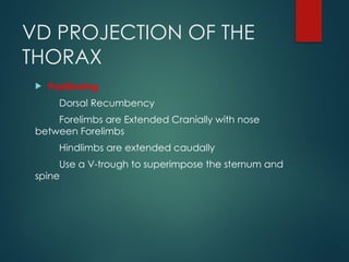 THORAX RADIOGRAPHIC TECHNIQUES INFORTHORAX XRAYMATION | PPTX