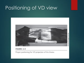 THORAX RADIOGRAPHIC TECHNIQUES INFORTHORAX XRAYMATION | PPTX