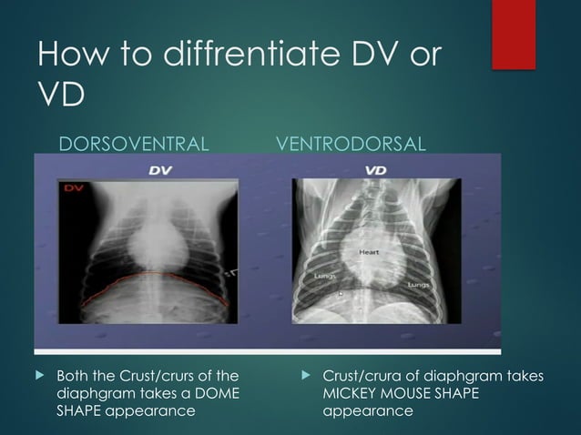 THORAX RADIOGRAPHIC TECHNIQUES INFORTHORAX XRAYMATION | PPT