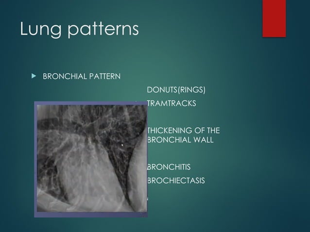 THORAX RADIOGRAPHIC TECHNIQUES INFORTHORAX XRAYMATION | PPT