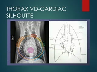 THORAX RADIOGRAPHIC TECHNIQUES INFORTHORAX XRAYMATION | PPTX