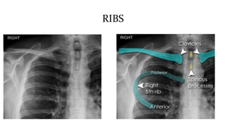 Thorax radiology | PPTX