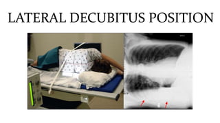 Thorax radiology | PPTX | Lung and Respiratory Health | Diseases and ...
