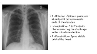 Thorax radiology | PPTX