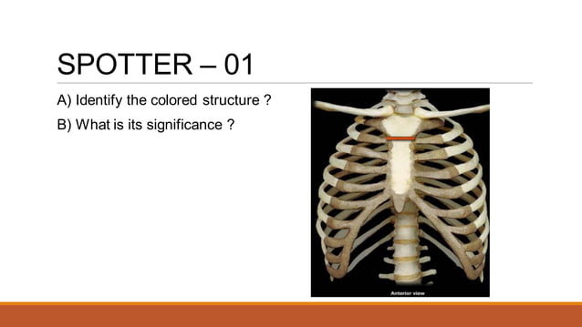 THORAX SPOTTERS-1_240531_065257.pdf..... | PDF