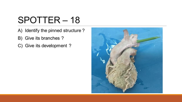THORAX SPOTTERS-1_240531_065257.pdf..... | PDF