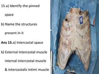 thorax spotters ppt.pptx