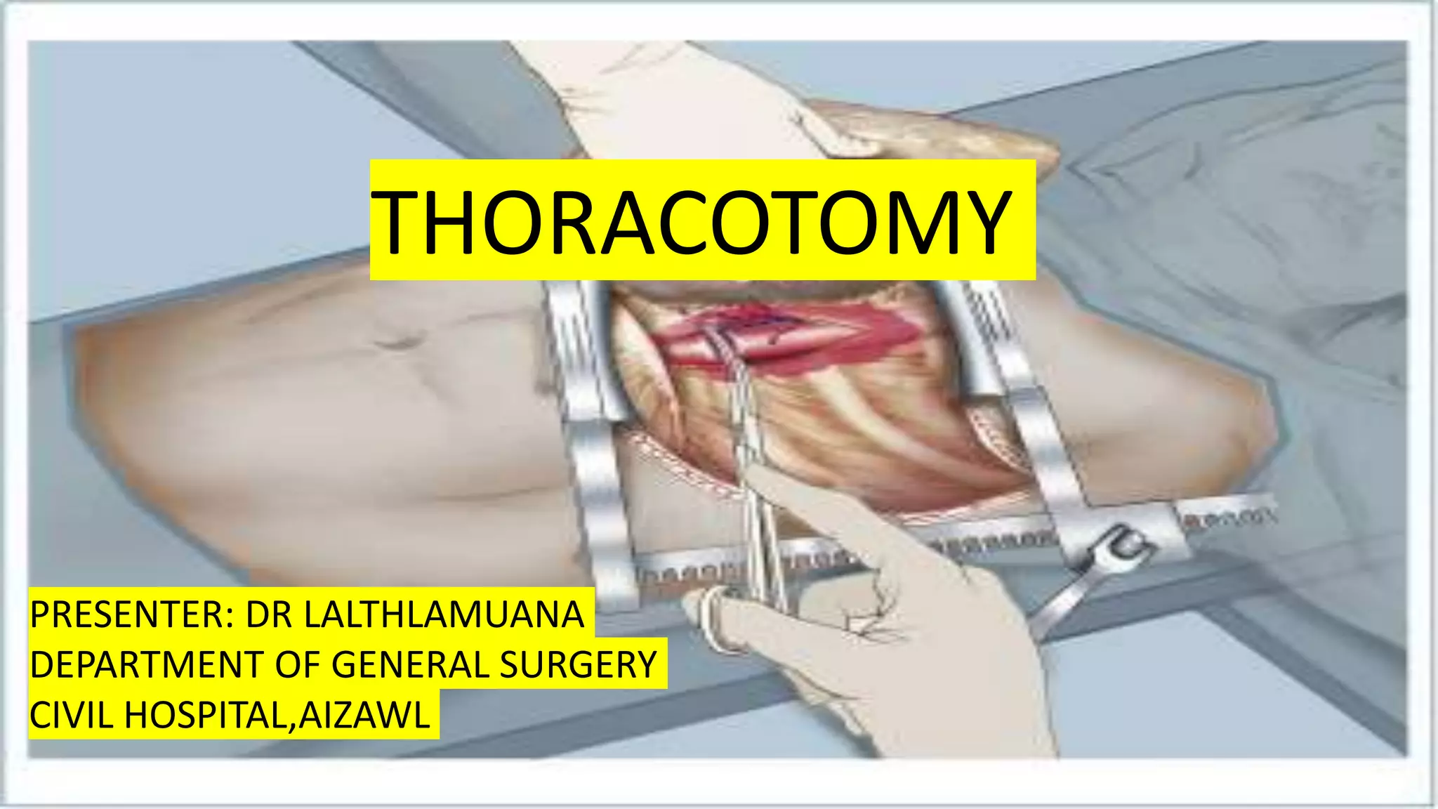 THORACOTOMY.pptx