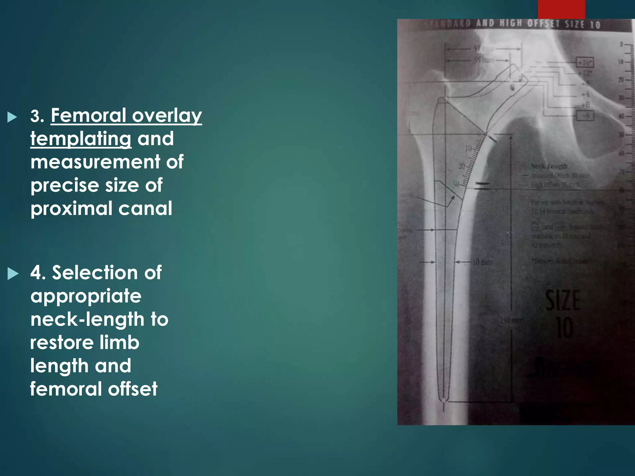 total hip arthroplasty | PPTX