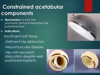 total hip arthroplasty | PPT