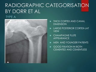 total hip arthroplasty | PPTX
