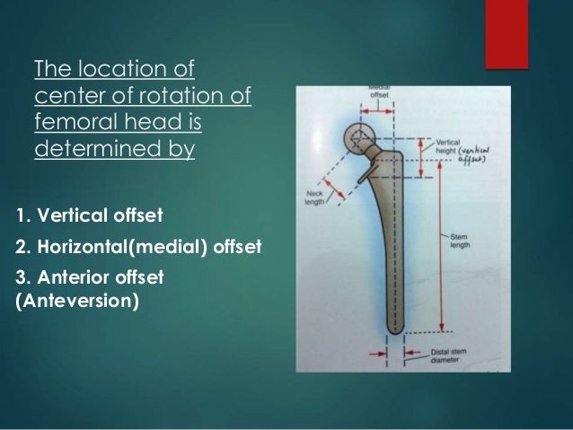 total hip arthroplasty