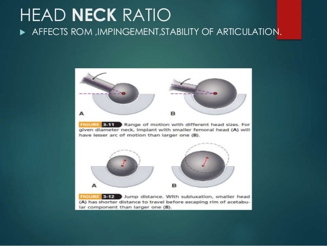 total hip arthroplasty