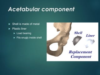 thr-ppt hip implant of human skeleton system -1.pdf