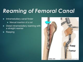thr-ppt hip implant of human skeleton system -1.pdf