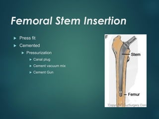 thr-ppt hip implant of human skeleton system -1.pdf